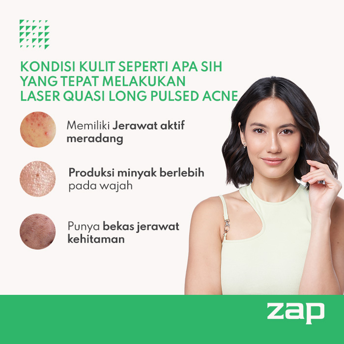 Laser Quasi Long Pulsed ZAP - ZAP Clinic