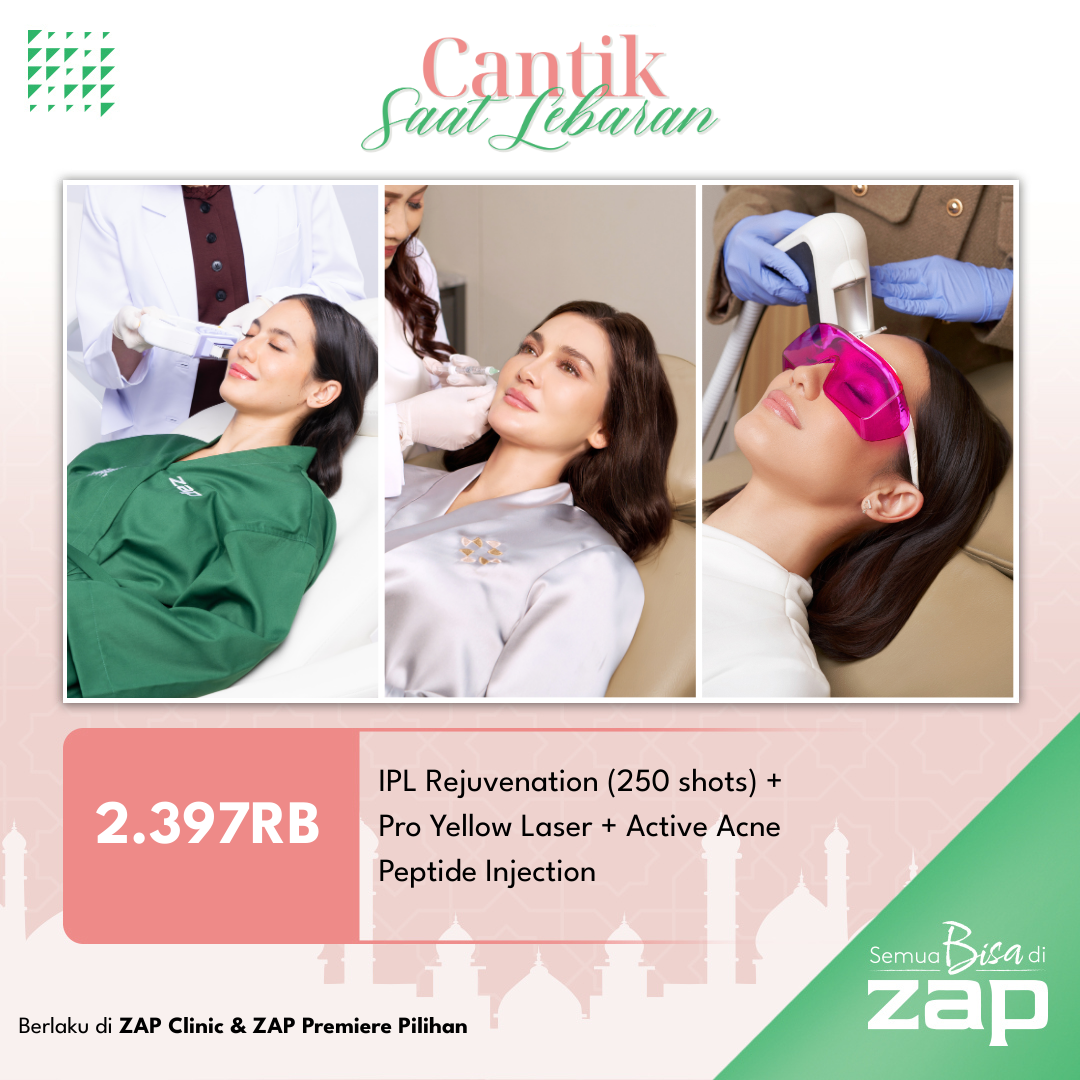 IPL Rejuvenation Double (250 shots) + Pro Yellow Laser + Active Acne P